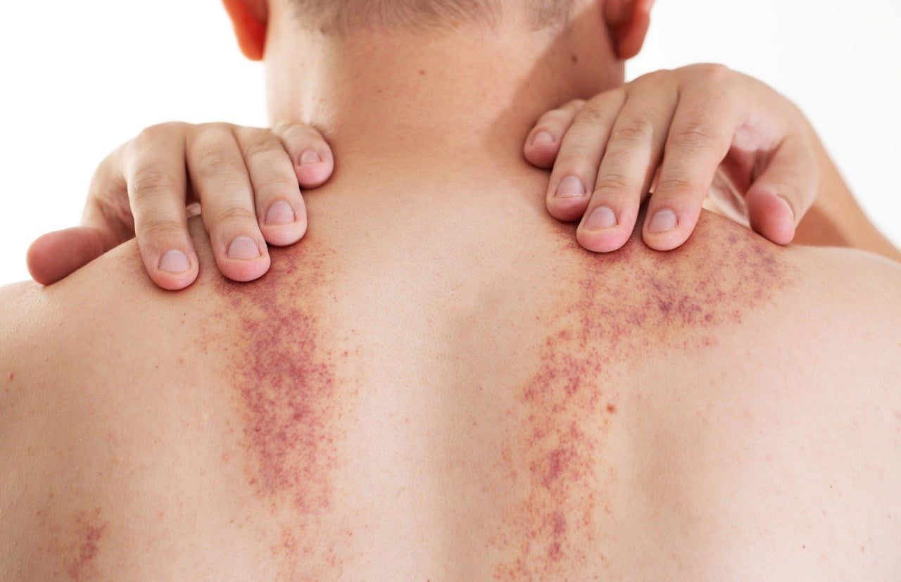 Best Shapewear Materials for Sensitive Skin – Esteem Apparel